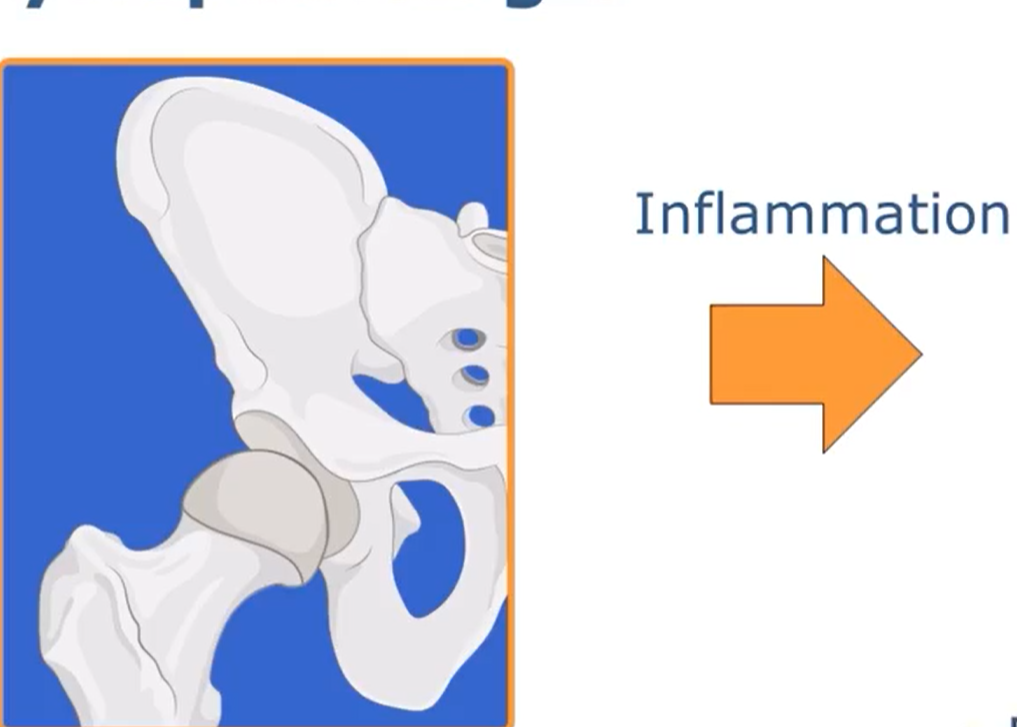 Pathologie et traumatologie de l'articulation coxo-fémorale: la ...